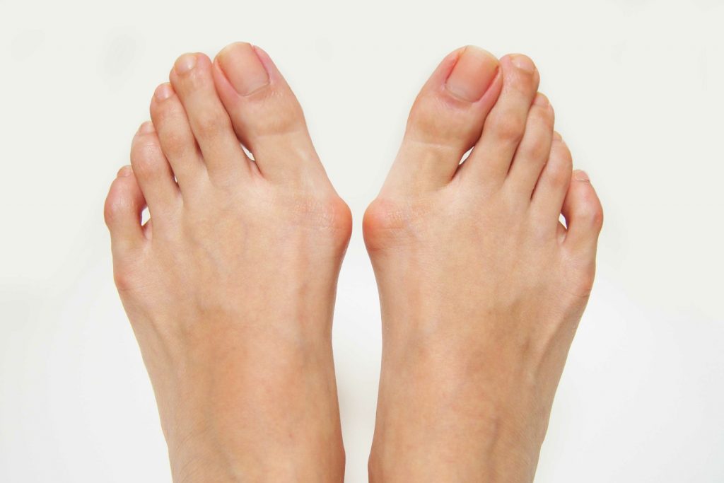 Toe Fracture Treatment | Protective Footwear | Orthotics Plus Melbourne