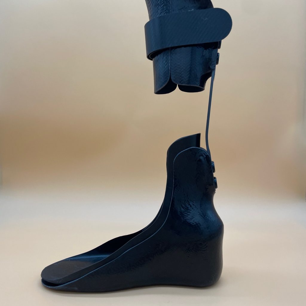 Information About Updating An AFO Prescription | Orthotics Plus Melbourne